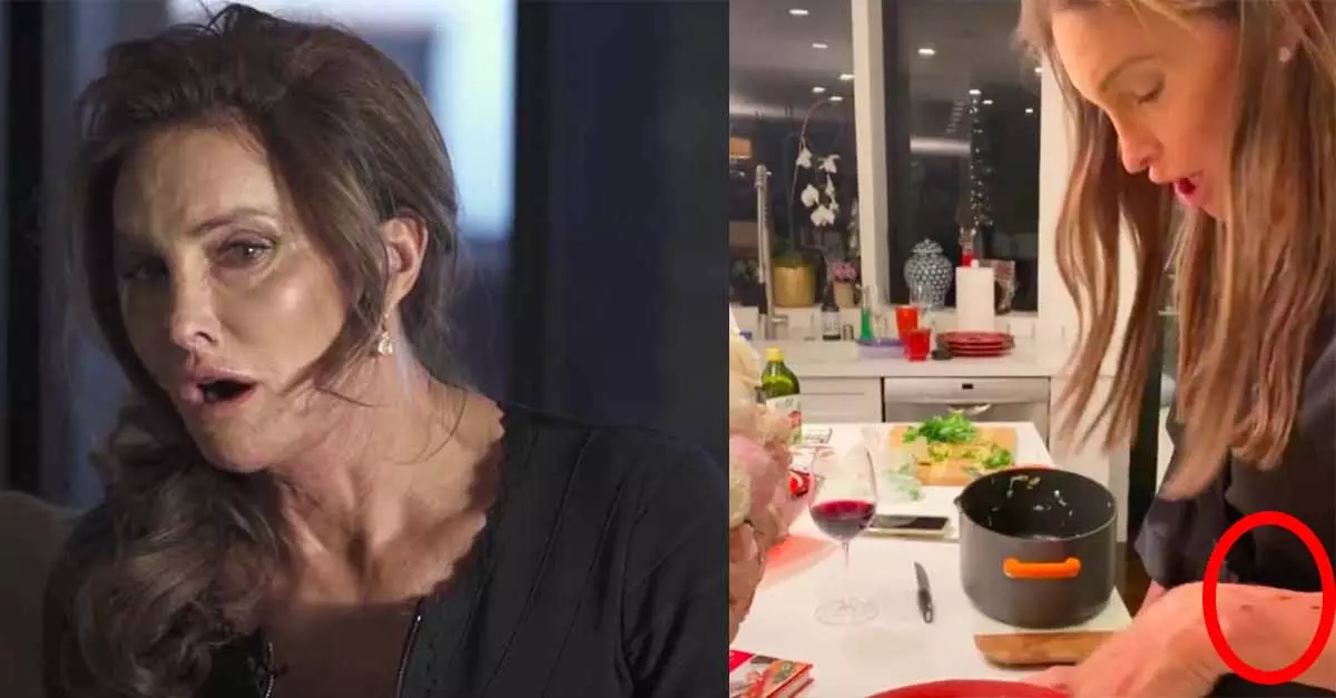 Caitlyn Jenner se liggaam 'misluk op haar' na plastiese chirurgie?